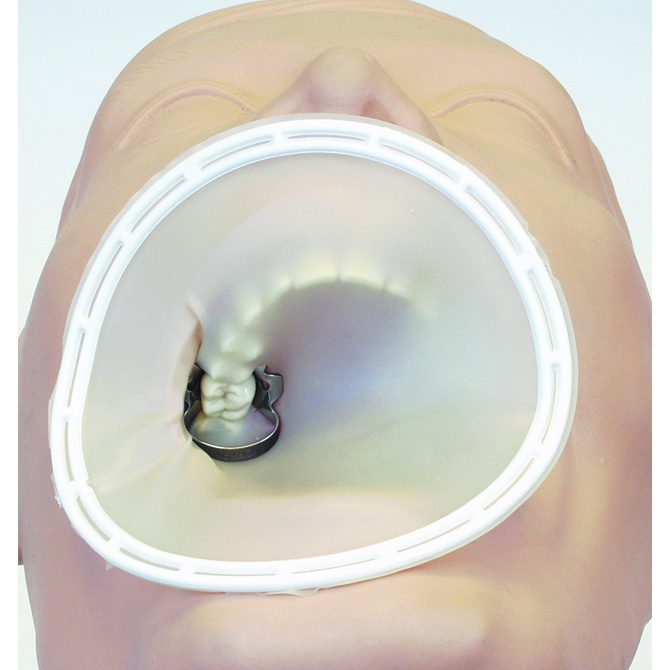 Insti-Dam Kofferdam - Technomedics